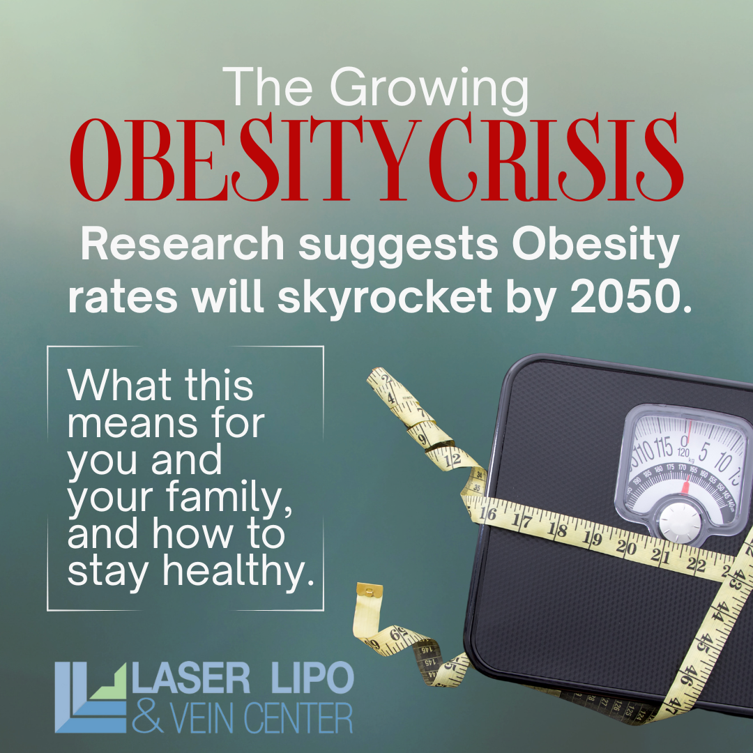 The Growing Obesity Crisis: What New Projections Mean for Missouri ...